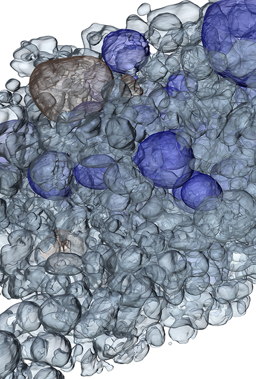 Excillum - Makers of the world's brightest microfocus X-ray tube