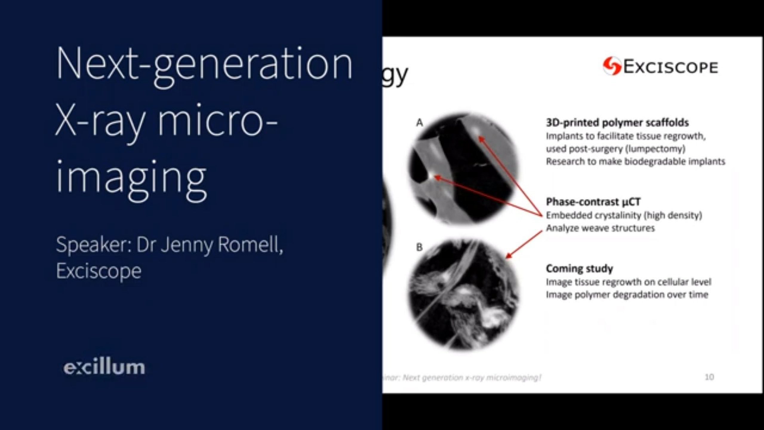 Next-generation X-ray microimaging - Excillum