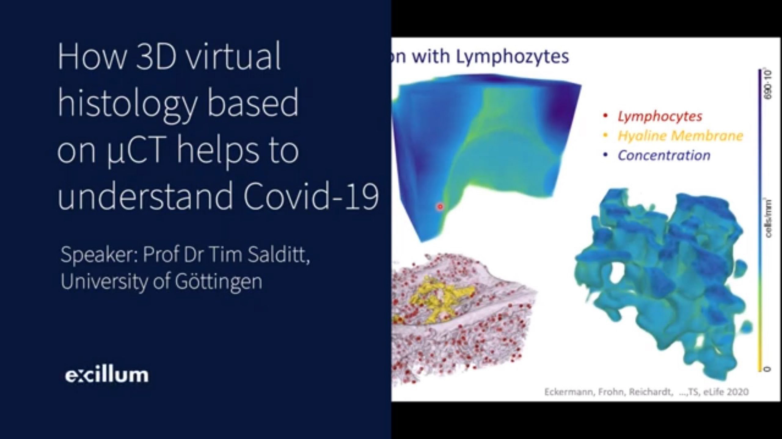 Understanding Covid-19 with 3D virtual histology based on micro-CT ...